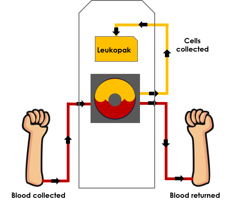 What is Leukapheresis?